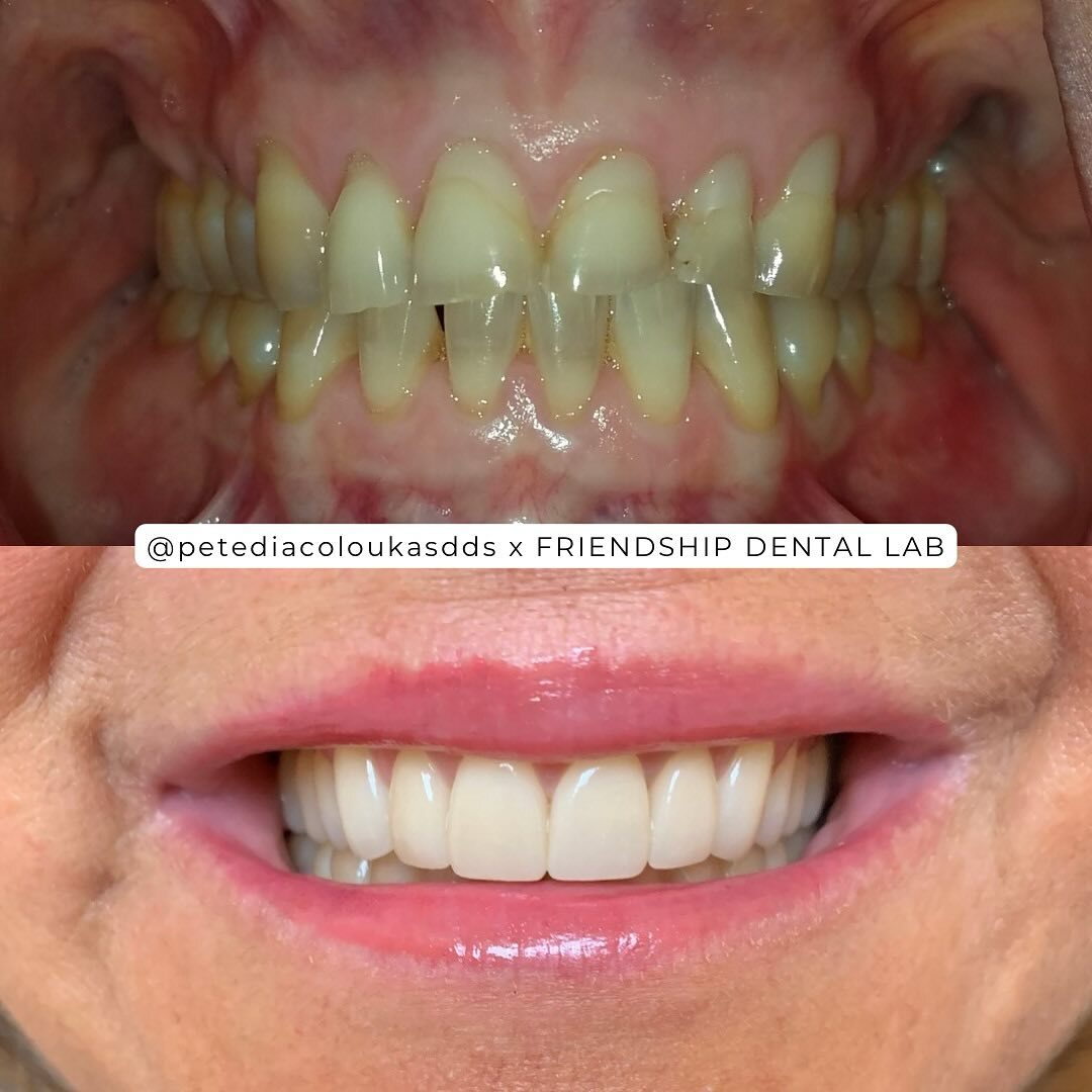 Friendship Dental Lab | Trusted Dental Lab Solutions Since 1973