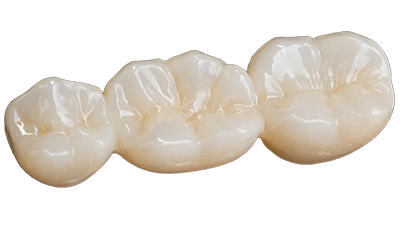 Friendship Dental Lab | Trusted Dental Lab Solutions Since 1973